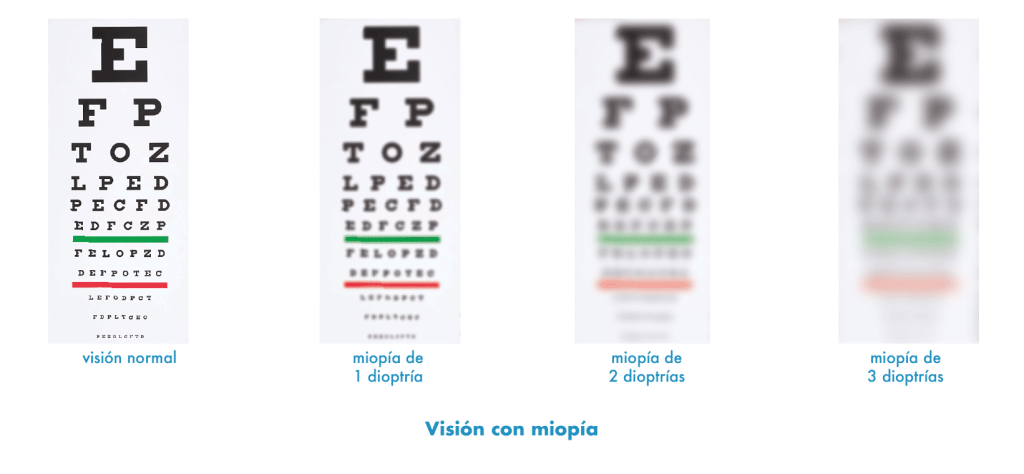 ¿Qué es una dioptría? - Óptica Azpilicueta